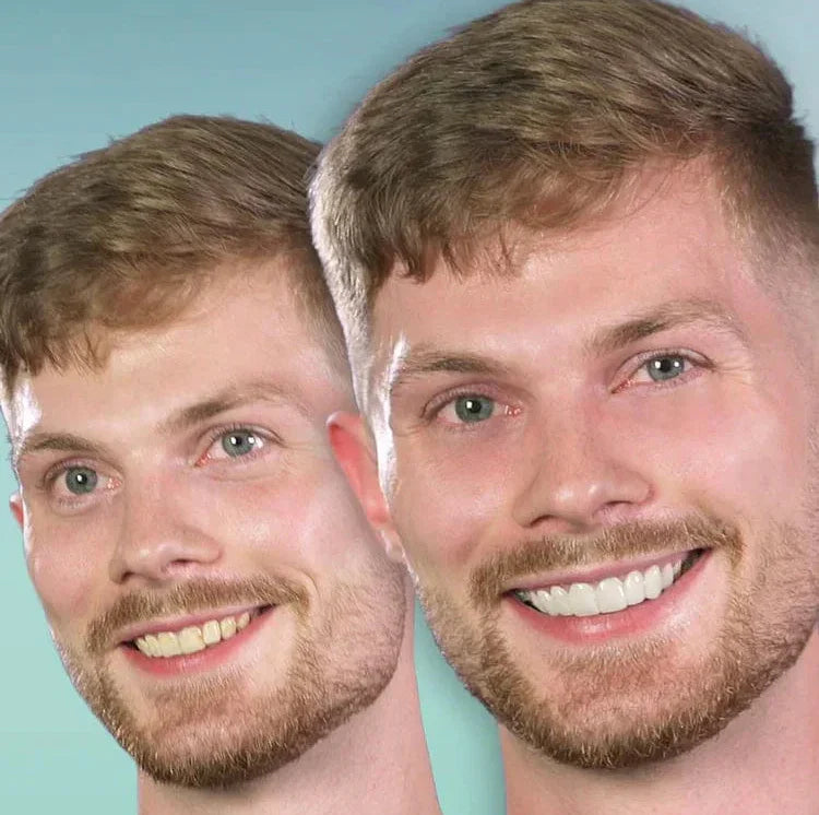 SmileFix | Instantly perfect smile – SohoBloo Shop