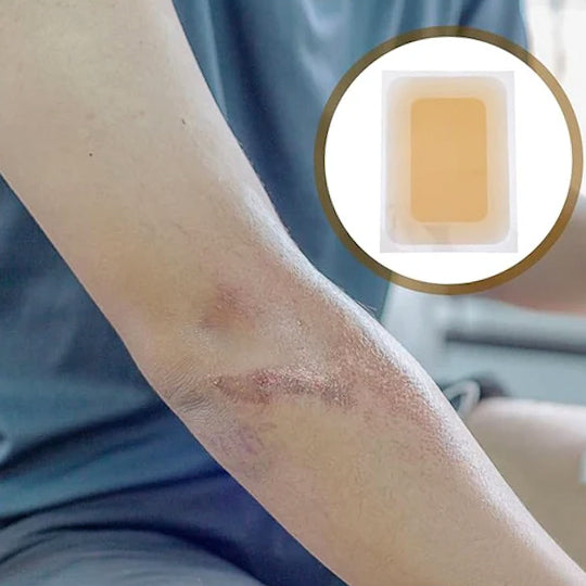 Invisiblend™ Tattoo & Scar Cover Patches - Seamlessly cover scars, tat ...